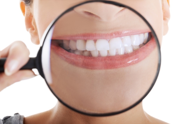 GLO Teeth Whitening…What You Need To Know